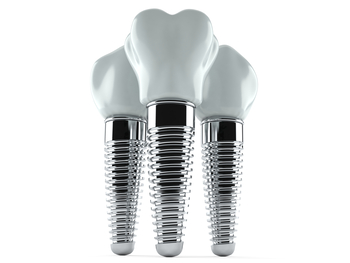 Unveiling The Truth About Any Dental Implant: Vietnam And Australia